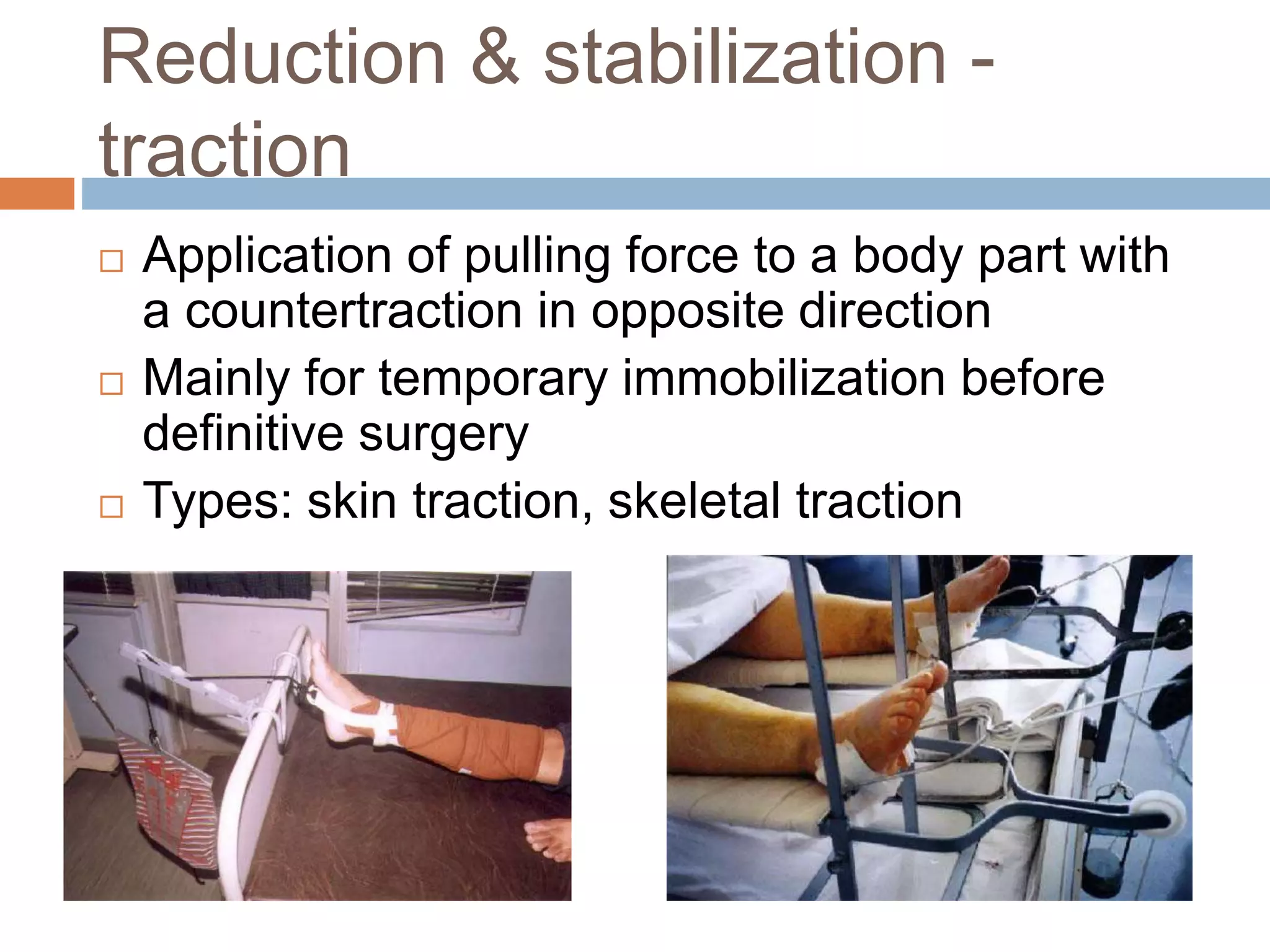Musculoskeletal trauma lecture | PPTX