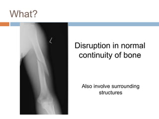 Musculoskeletal trauma lecture | PPTX