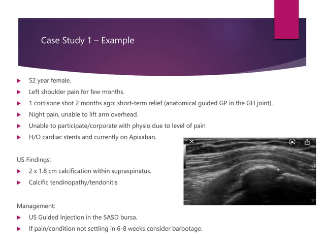 MSK Ultrasound and Guided Injections in Private Practice | PPTX