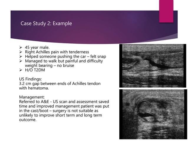 MSK Ultrasound and Guided Injections in Private Practice | PPTX