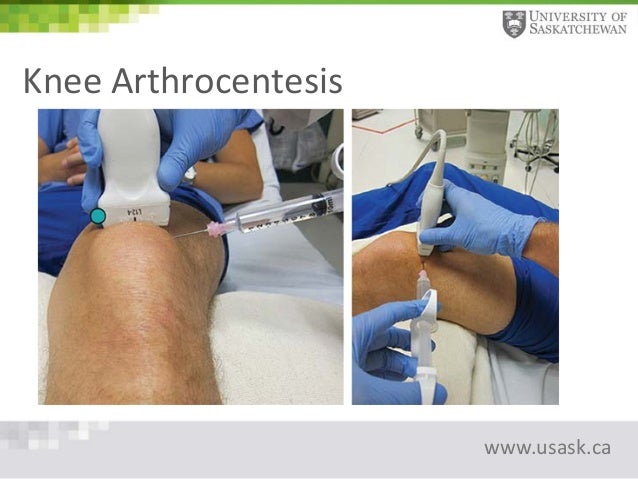 Musculoskeletal ultrasound in sports medicine FMF 2015