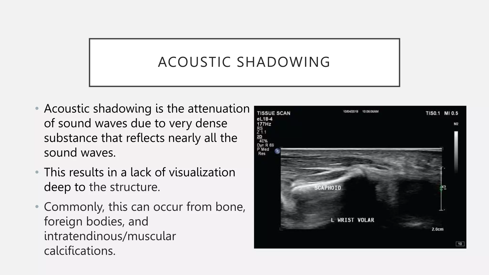 Musculoskeletal USG.pptx