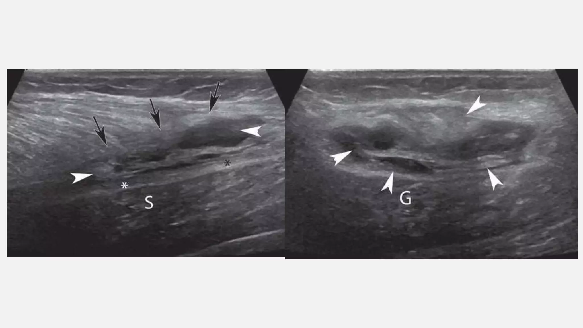 Musculoskeletal USG.pptx