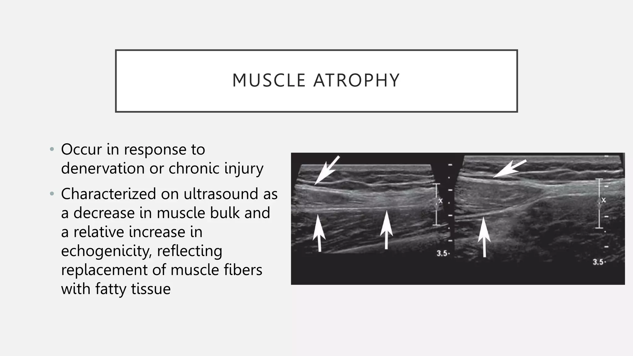 Musculoskeletal USG.pptx