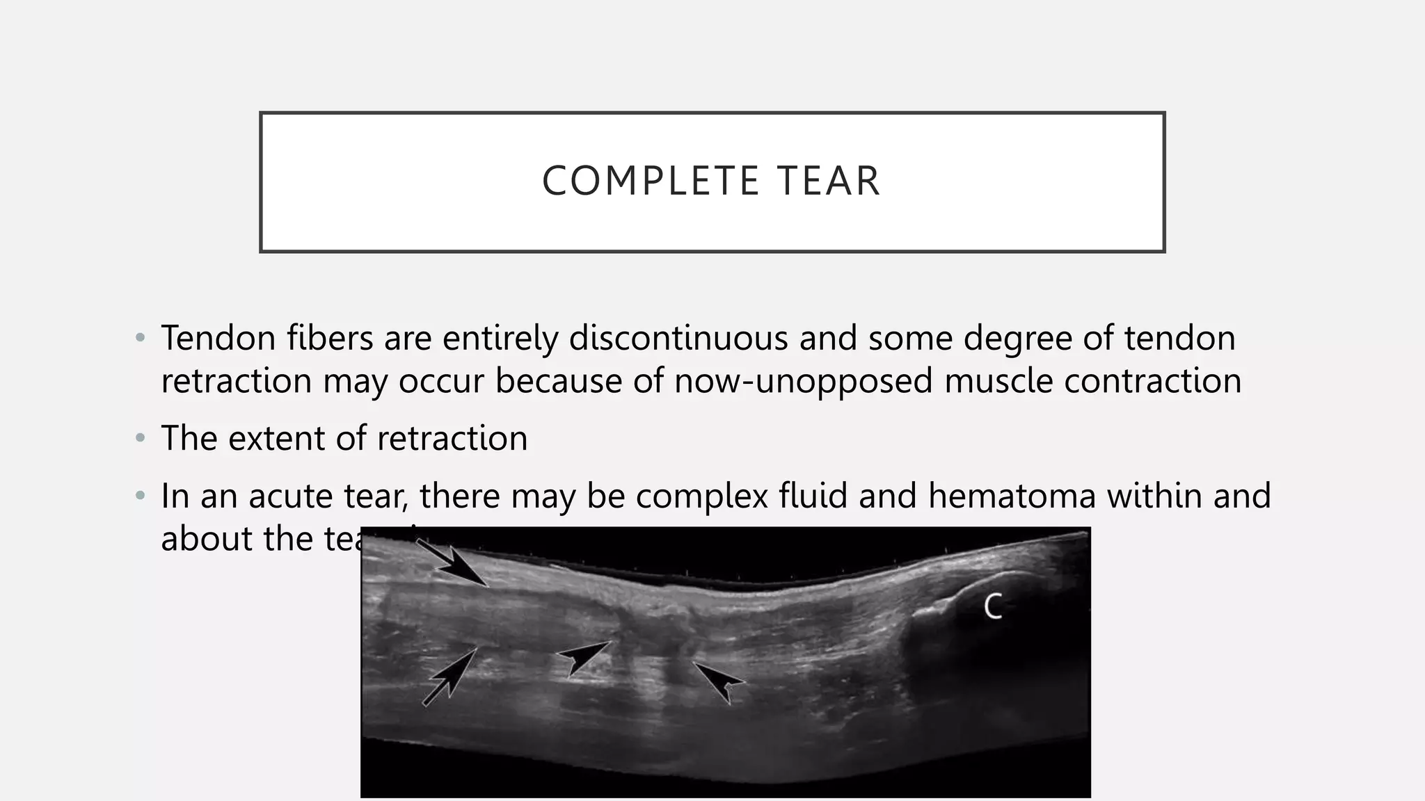 Musculoskeletal USG.pptx