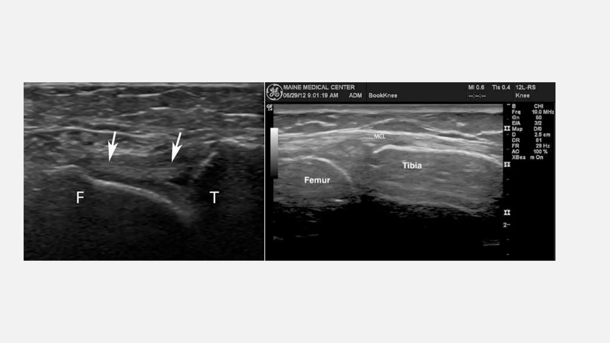 Musculoskeletal USG.pptx