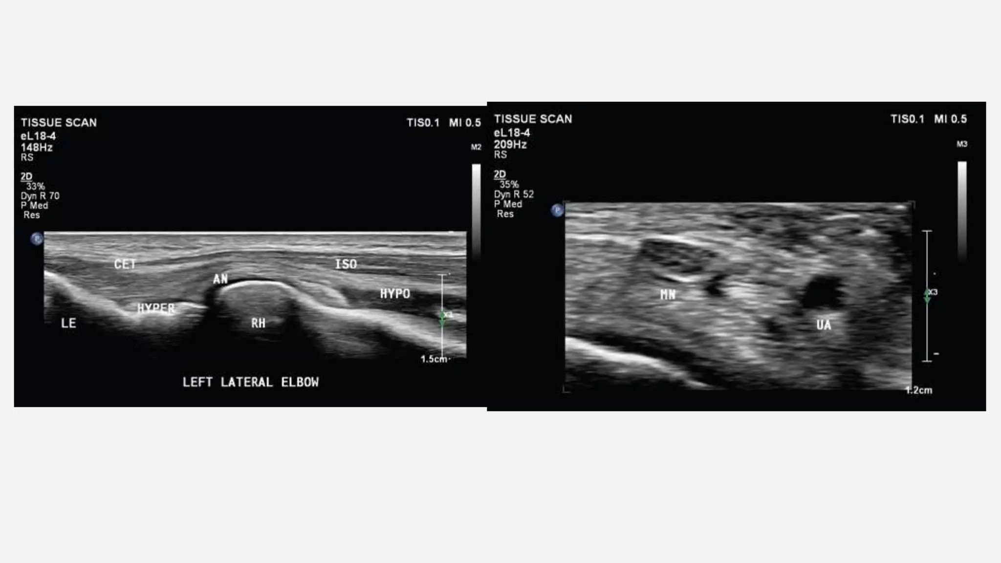Musculoskeletal USG.pptx