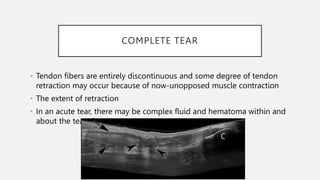 Musculoskeletal USG.pptx