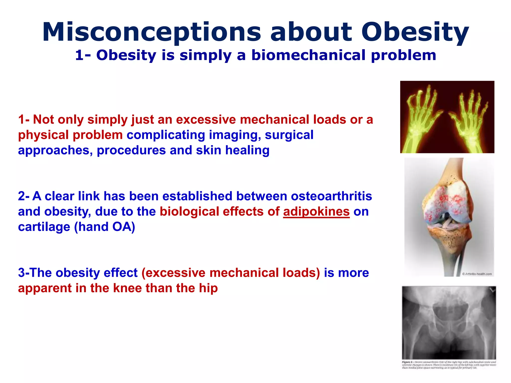 Musculoskletal manifestations of Obesity | PPTX