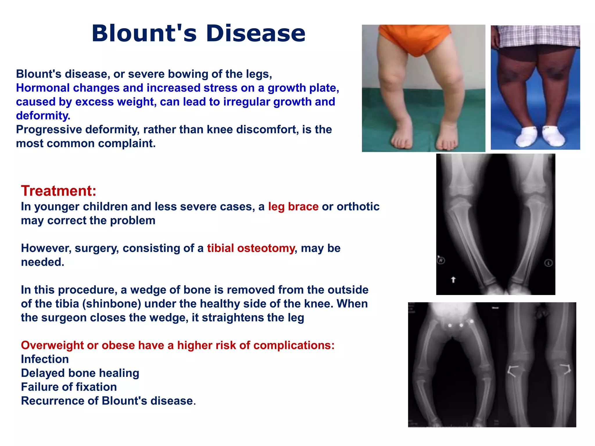Musculoskletal manifestations of Obesity | PPTX