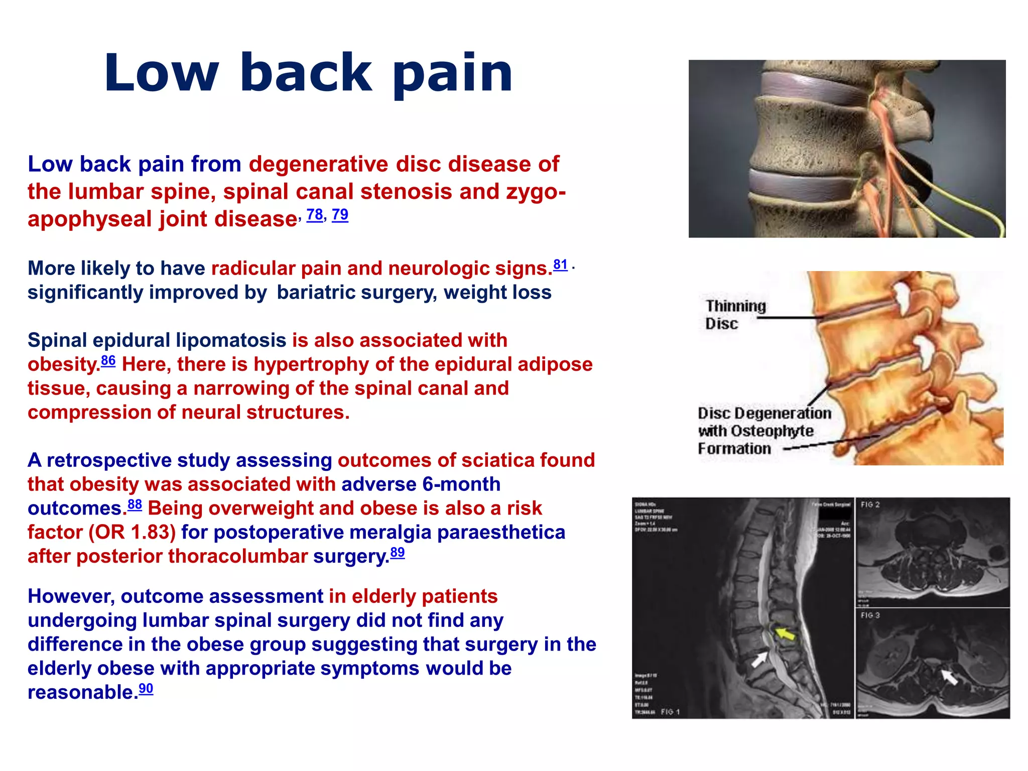 Musculoskletal manifestations of Obesity | PPTX