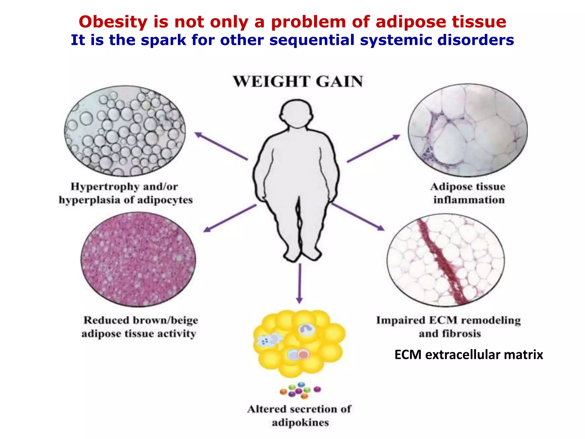 Musculoskletal manifestations of Obesity | PPTX