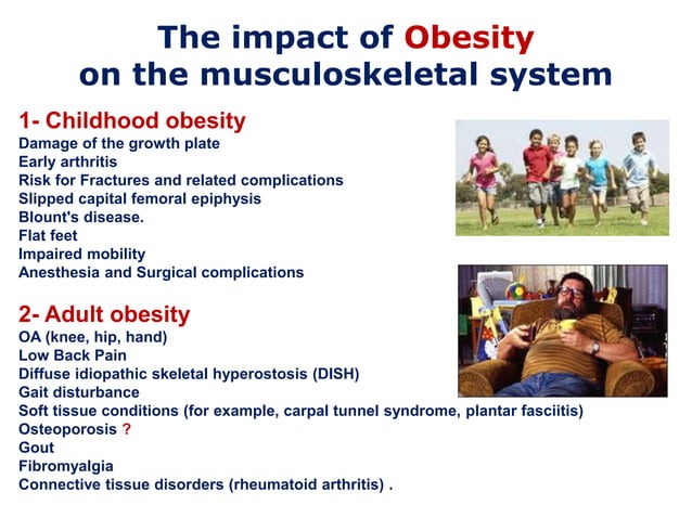Musculoskletal manifestations of Obesity | PPT