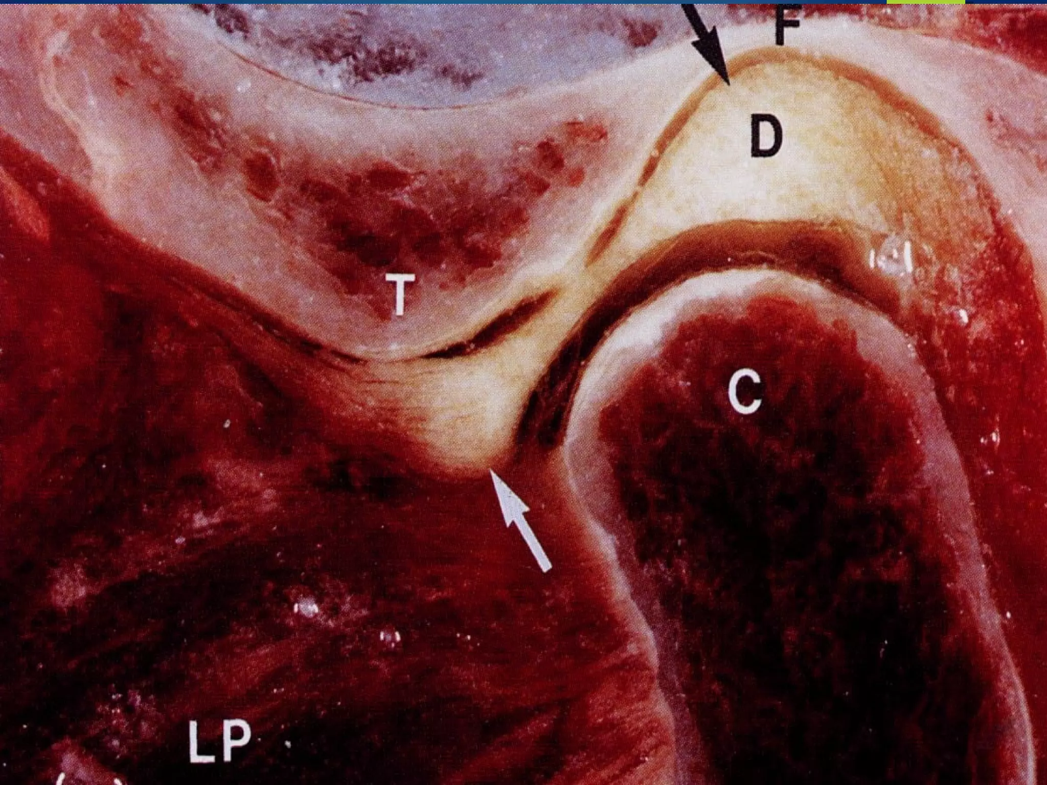 Musculos, ligamentos y atm | PPT