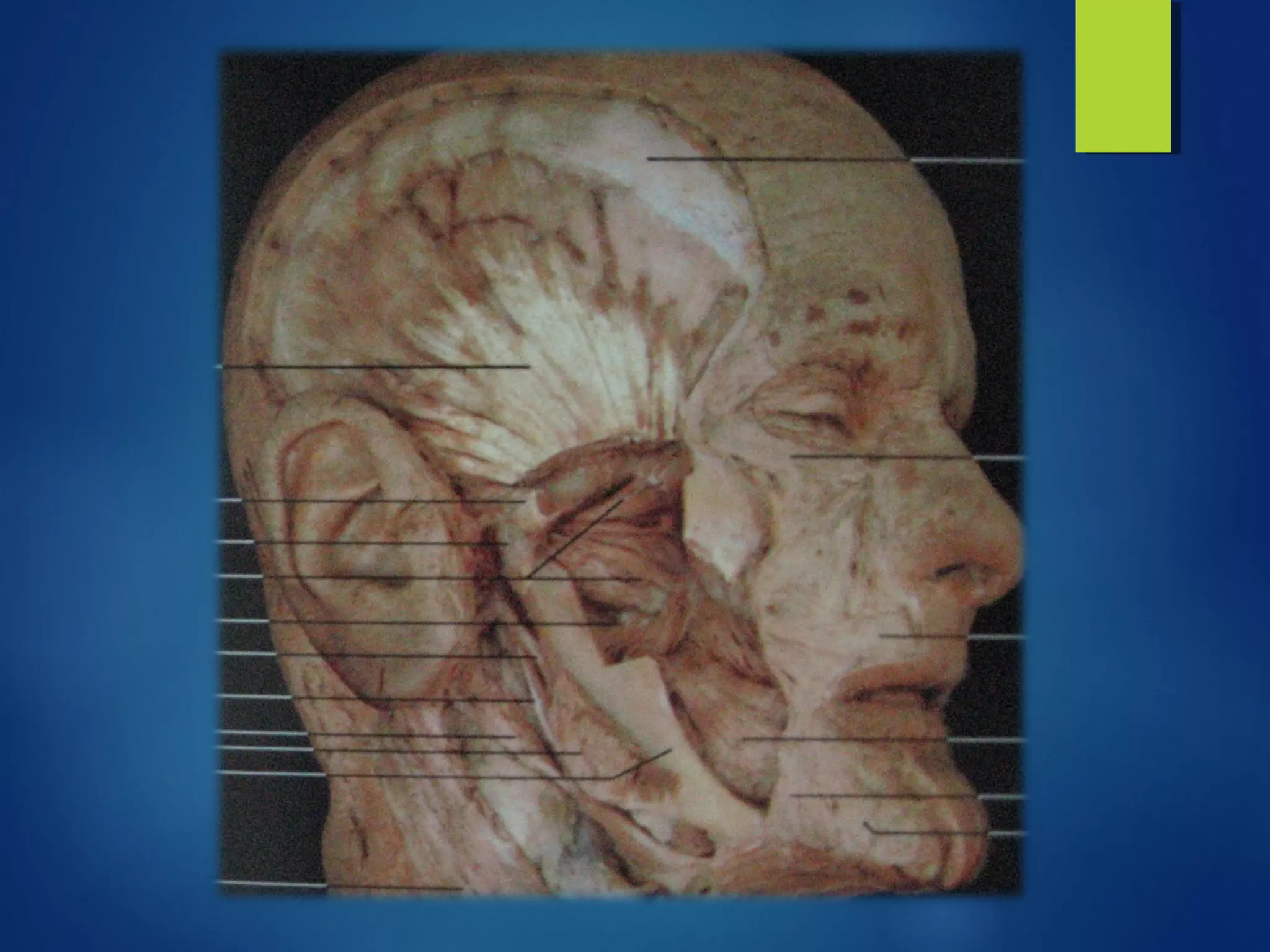 Musculos, ligamentos y atm | PPT