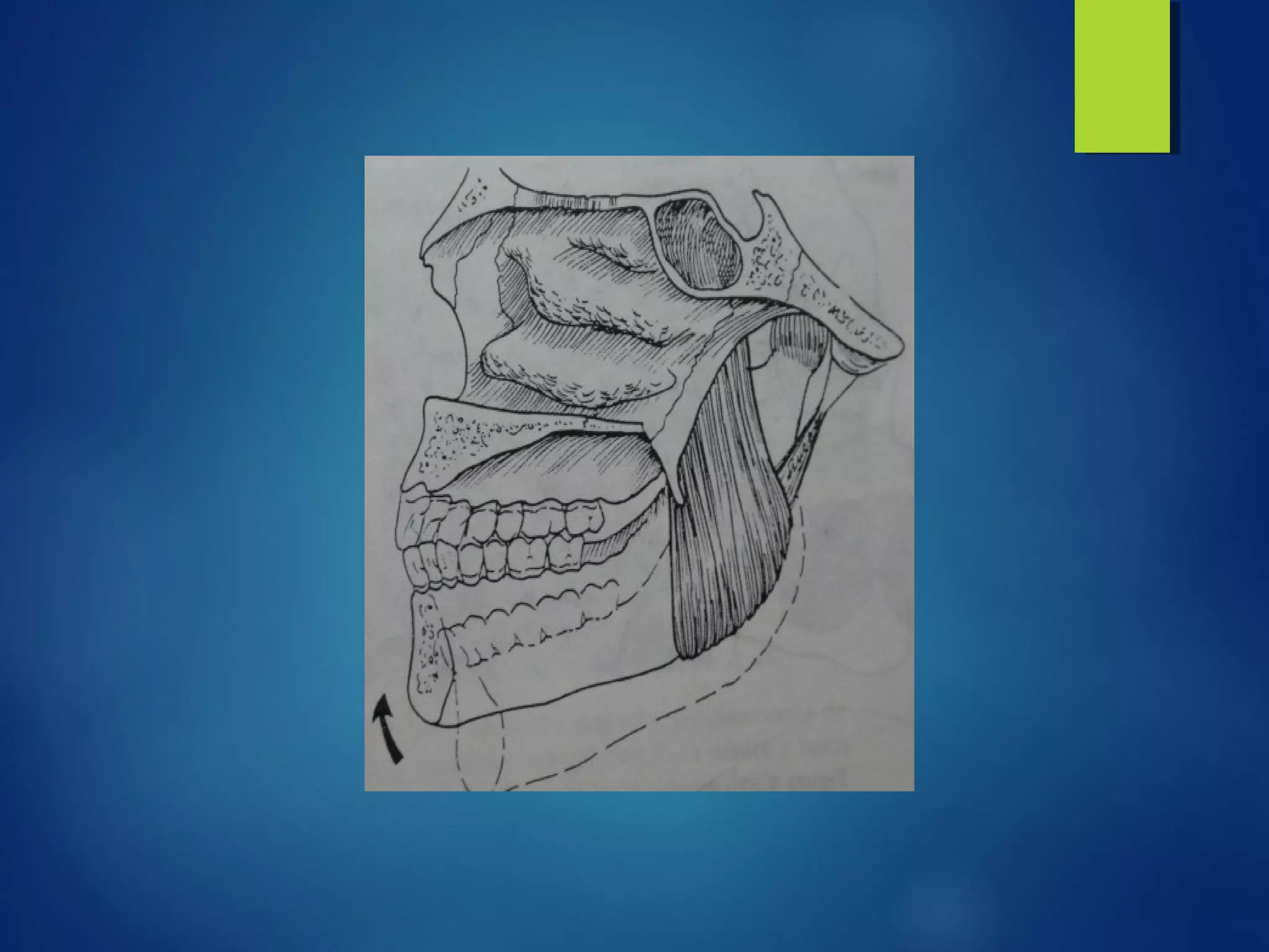 Musculos, ligamentos y atm | PPT