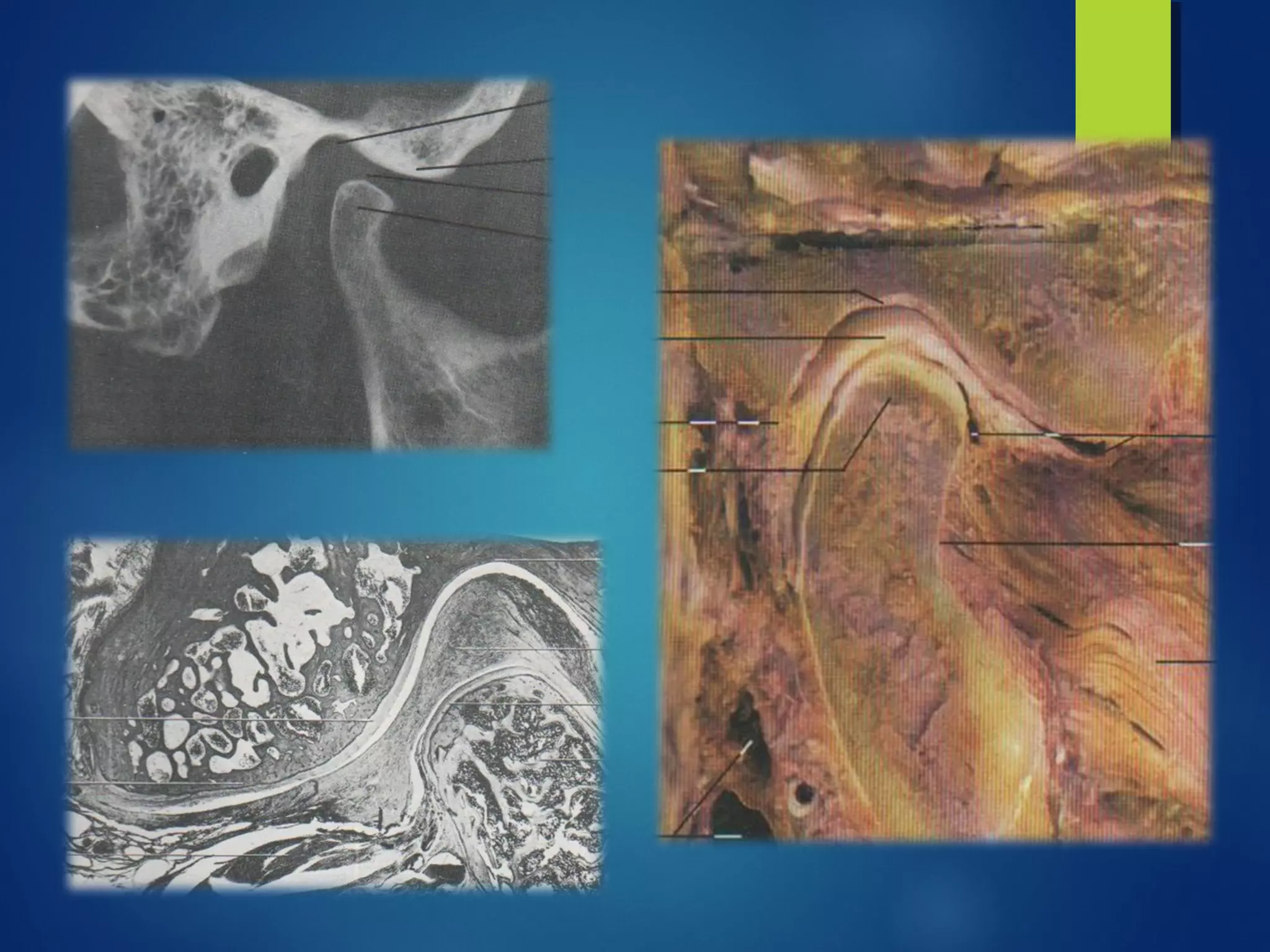 Musculos, ligamentos y atm | PPT
