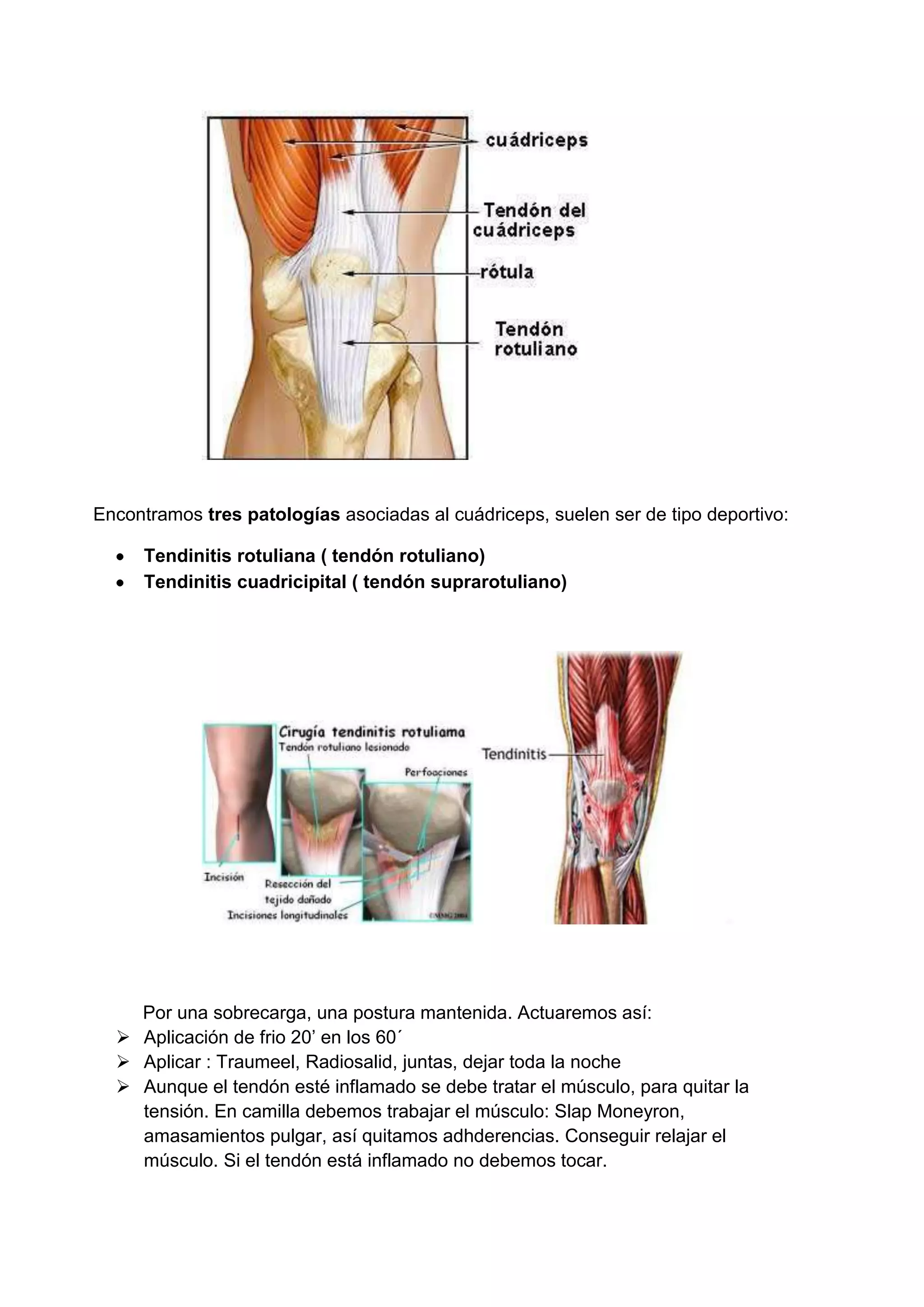 Musculos muslo | DOCX