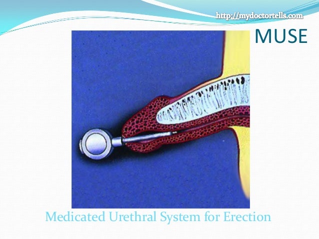 M.U.S.E.Treatment Erectile Dysfunction