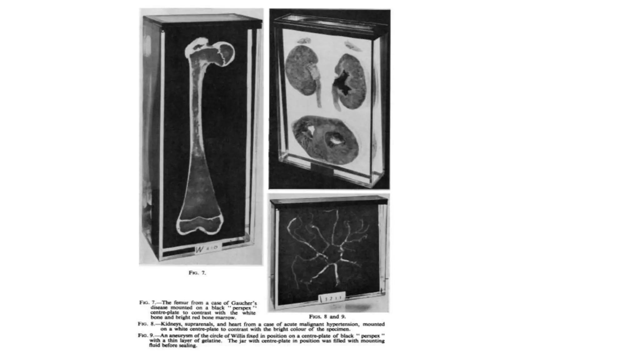 museum techniques in pathology.pptx