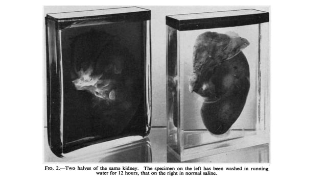 museum techniques in pathology.pptx | First Aid | Injuries