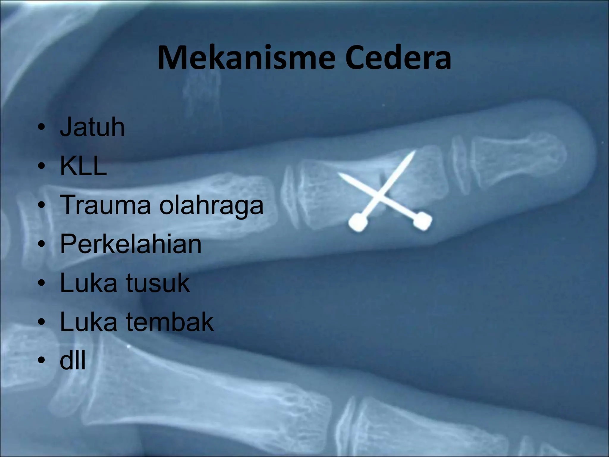Muskuloskeletal Emergency.ppt