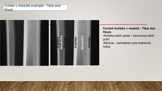 Muskuloskeletal Radiology Basic Overview.pptx