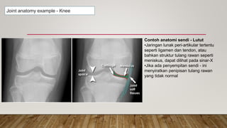Muskuloskeletal Radiology Basic Overview.pptx
