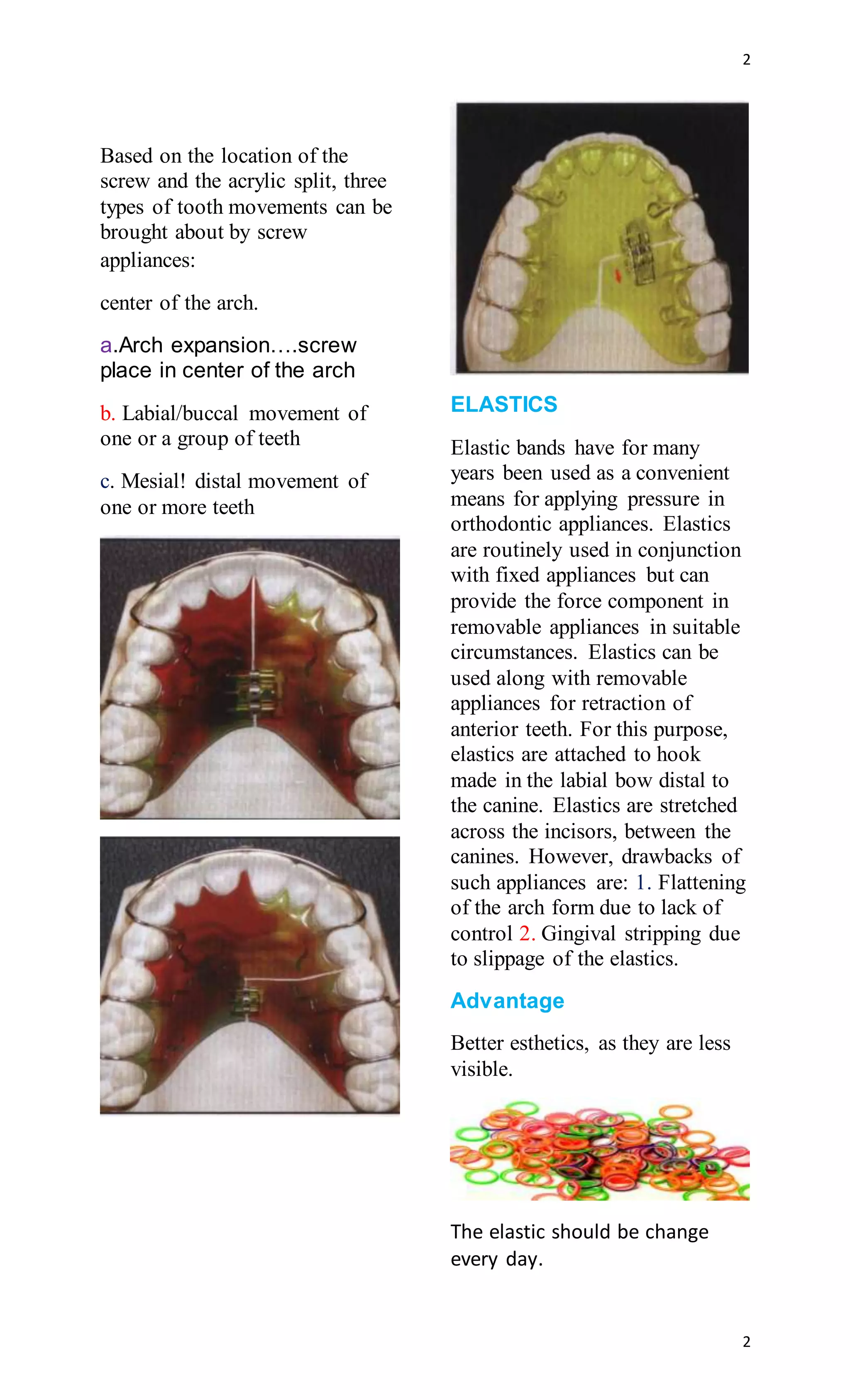 Removable orthodontic appliances part 2 | DOCX