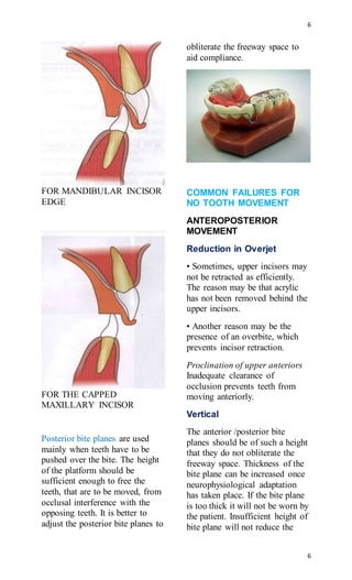 Removable orthodontic appliances part 2 | DOCX