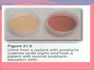 HEME METABOLISM MUHAMMAD MUSTANSAR | PPT