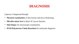 LEPROSY, IT'S TREATMNENT, CAUSES AND SYMPTOMS | PPTX