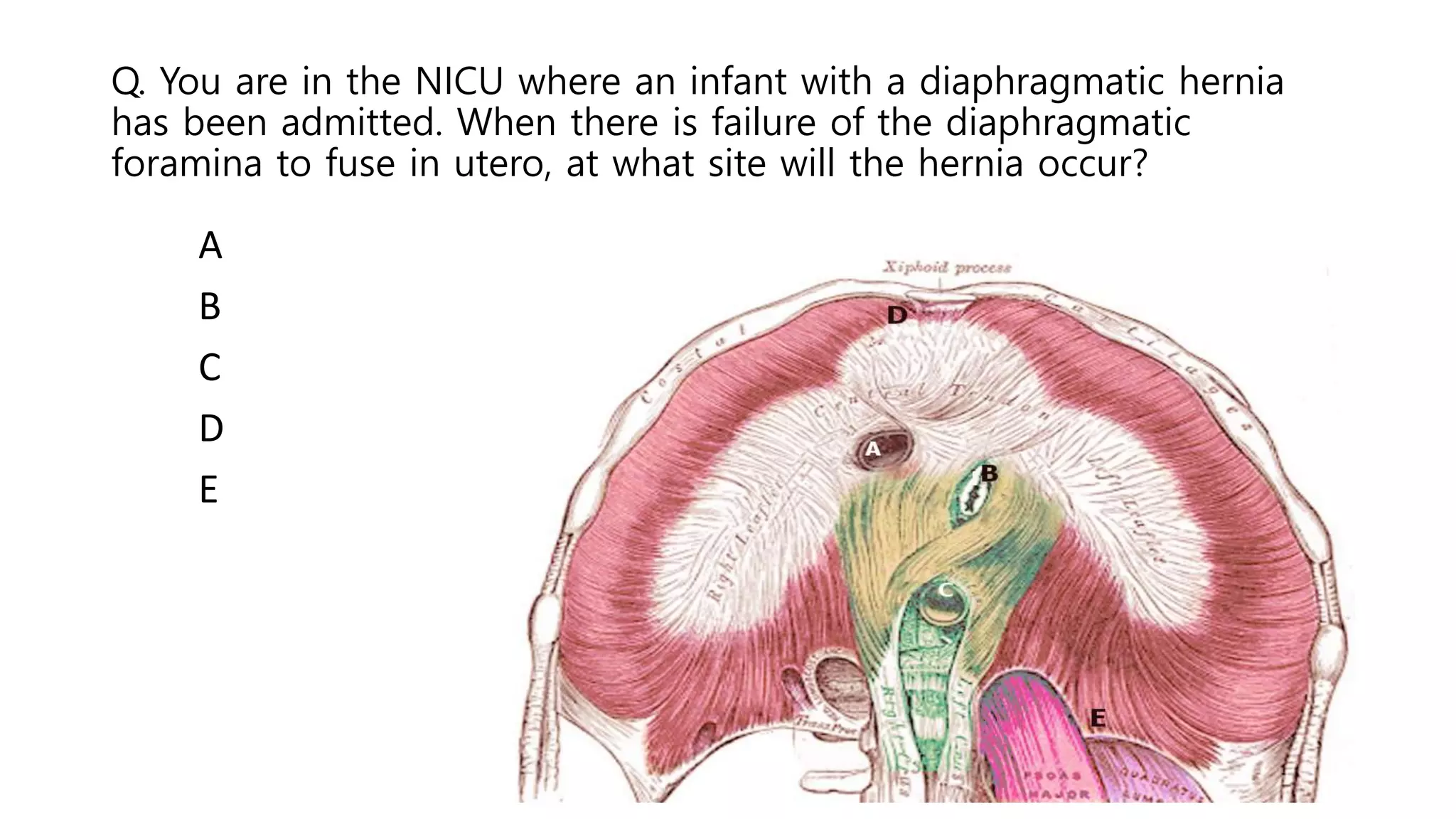 Must Know Diaphragm Anatomy MCQs | PPTX