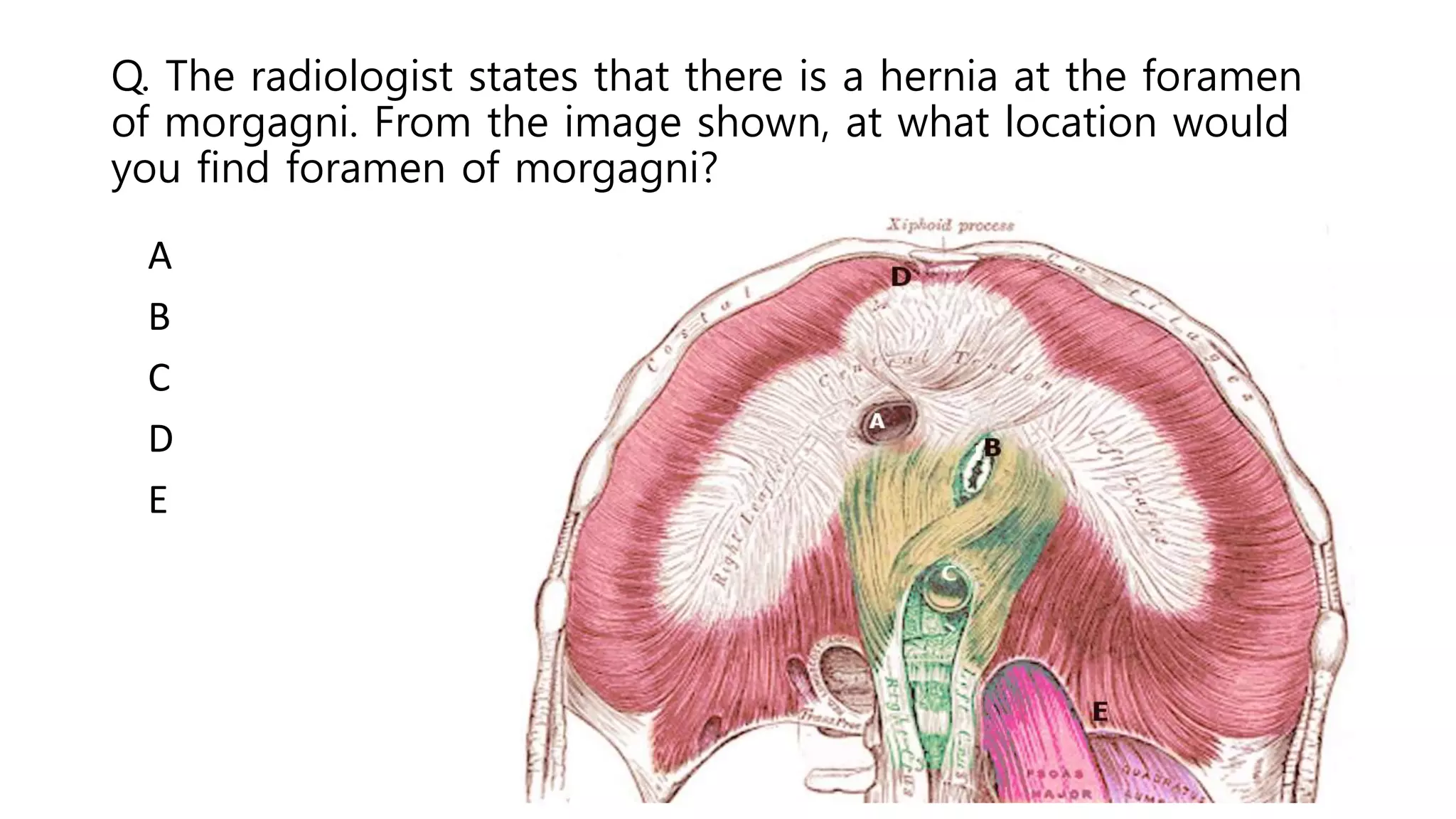 Must Know Diaphragm Anatomy MCQs | PPTX