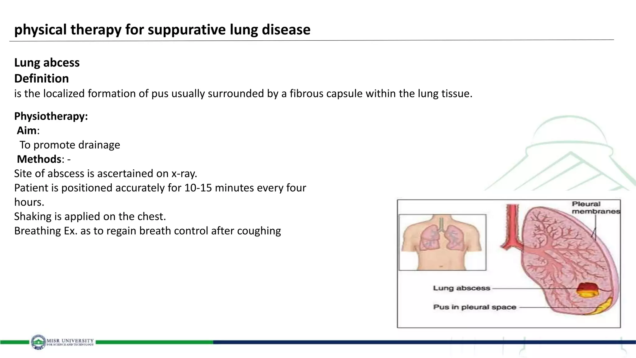 physical therapy for suppurative lung disease | PPTX