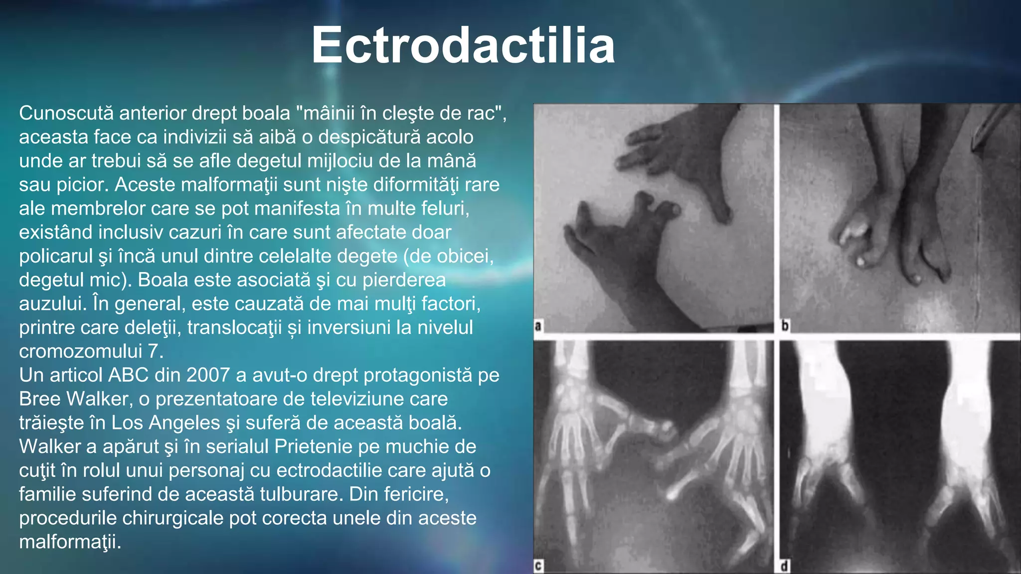 Mutatiile genetice Ciubarov Daniel | PPTX