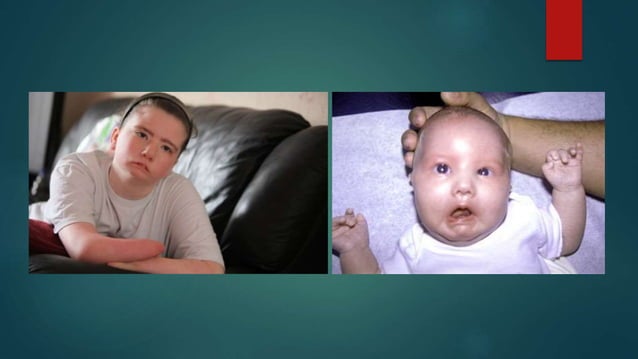 Mutatiile genetice anomalii genice si cromozomiale | PPTX