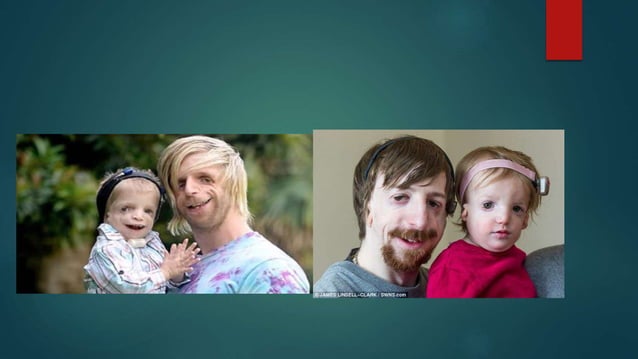 Mutatiile genetice anomalii genice si cromozomiale | PPTX