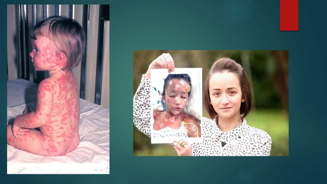 Mutatiile genetice anomalii genice si cromozomiale | PPTX