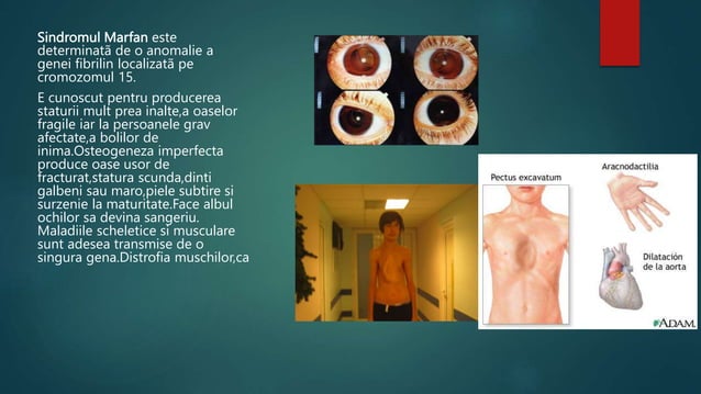 Mutatiile genetice anomalii genice si cromozomiale | PPTX