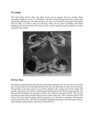 Mutatio | DOCX | Skin and Dermatology | Diseases and Conditions