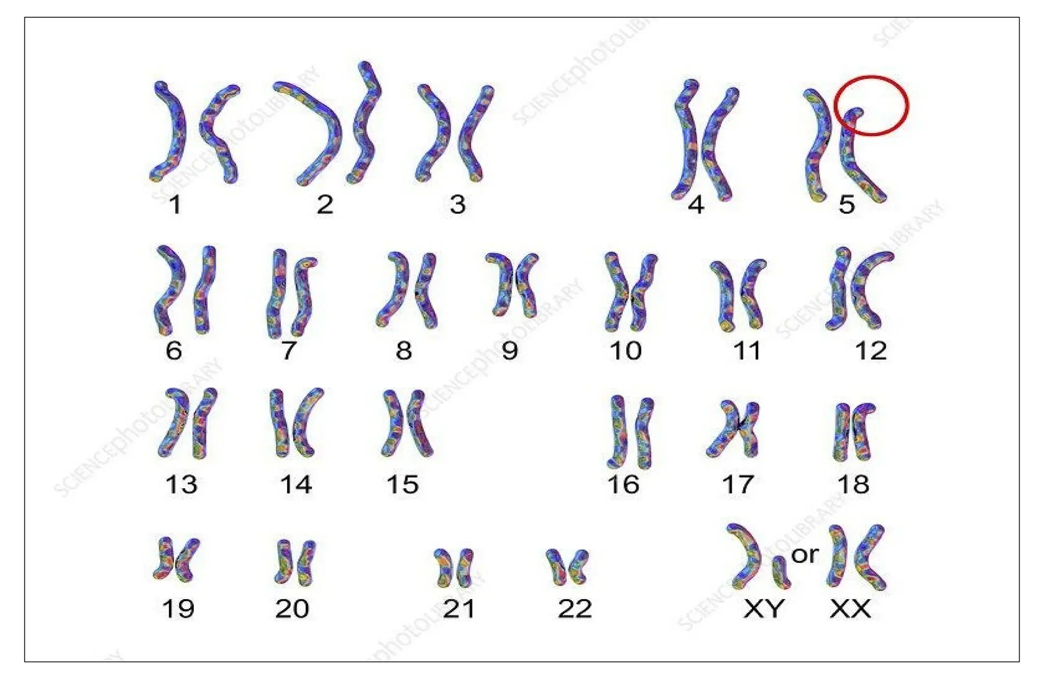 MUTATION and some GENETIC DISORDERS.pptx