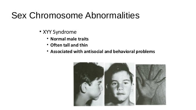 Xxyy Syndrome Symptoms