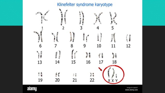 Science Mutations That Occur In Sex Cells Pptx Infertility Reproductive Health