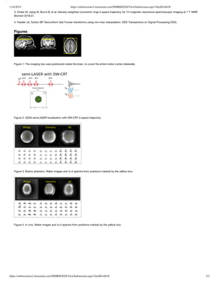 Multi-Vendor Implementation and Comparison of Hanning Filter Density ...