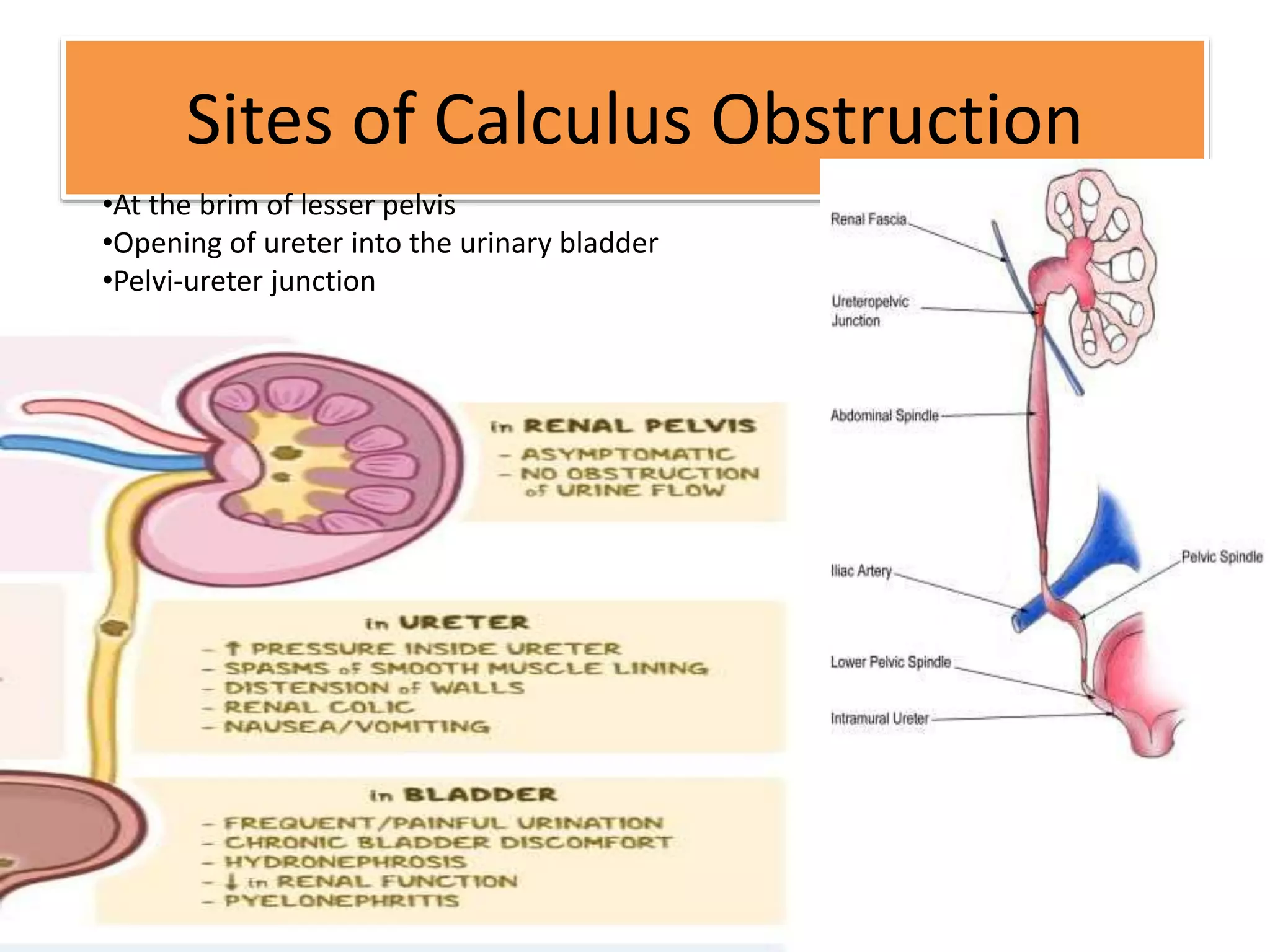 Mutraashmari (Urolithiasis).pptx