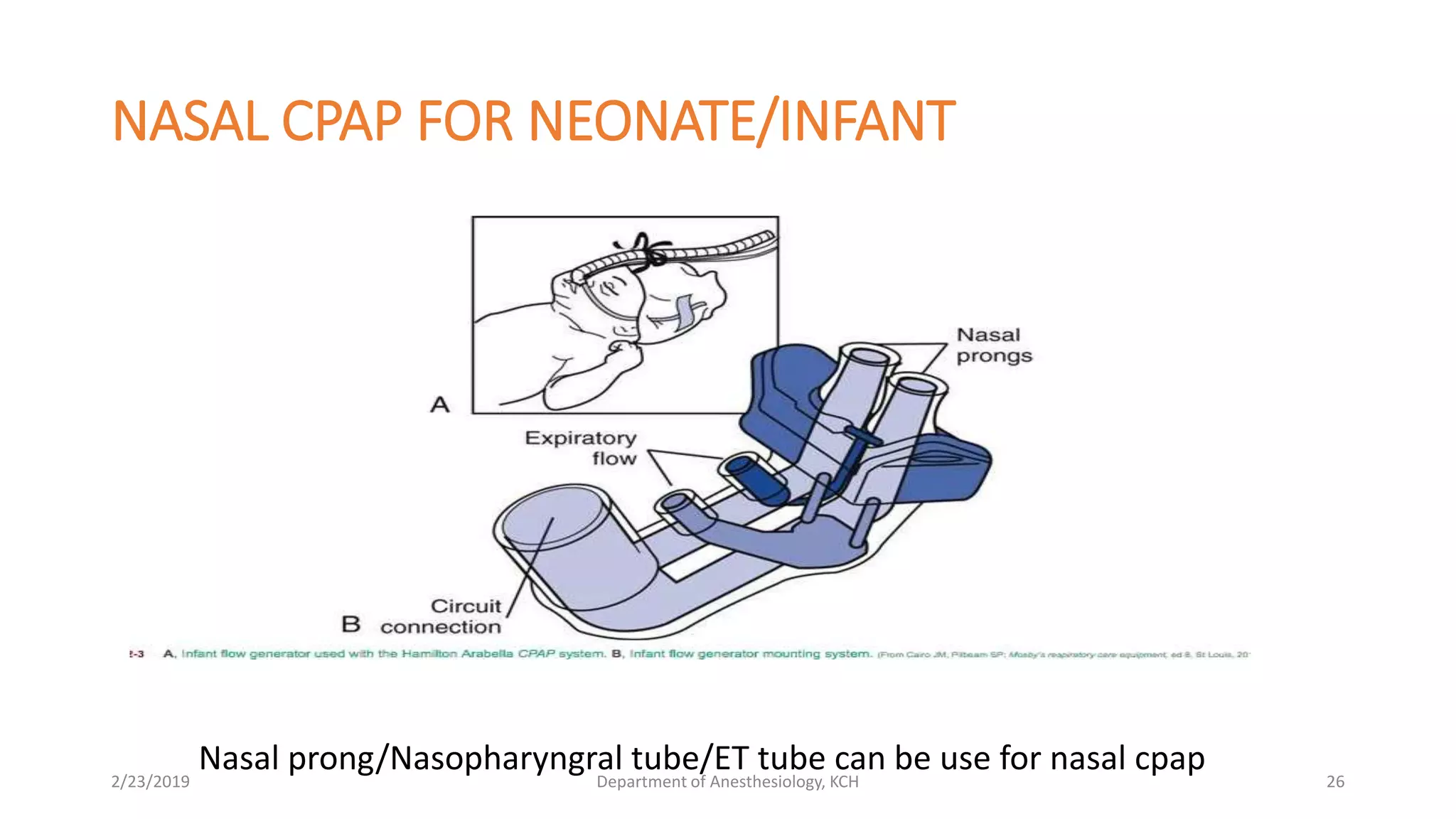 Mechanical Ventilation -Modes for Pediatrics | PPTX