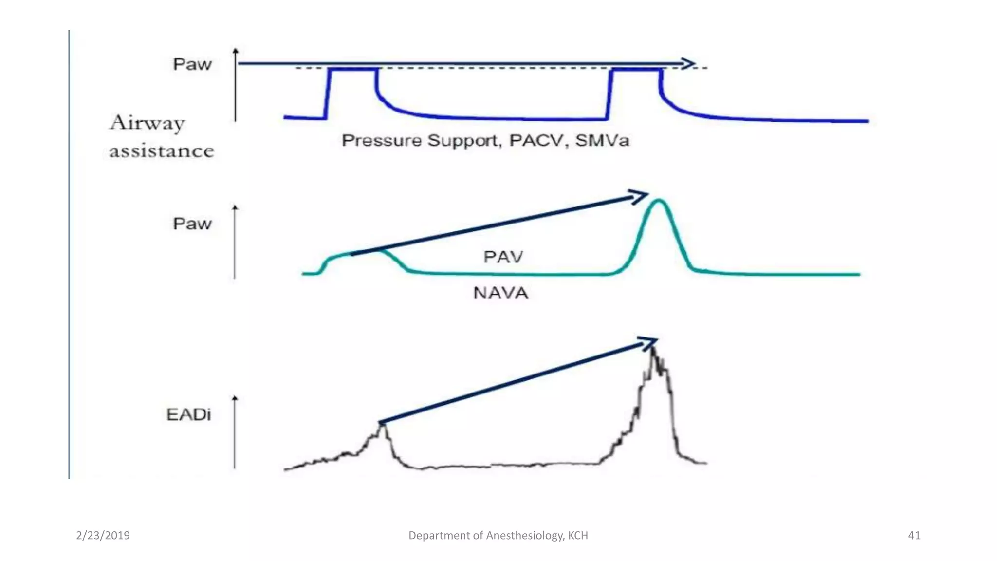 Mechanical Ventilation -Modes for Pediatrics | PPTX