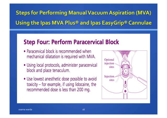 MANUAL VACUUM ASPIRATION | PDF