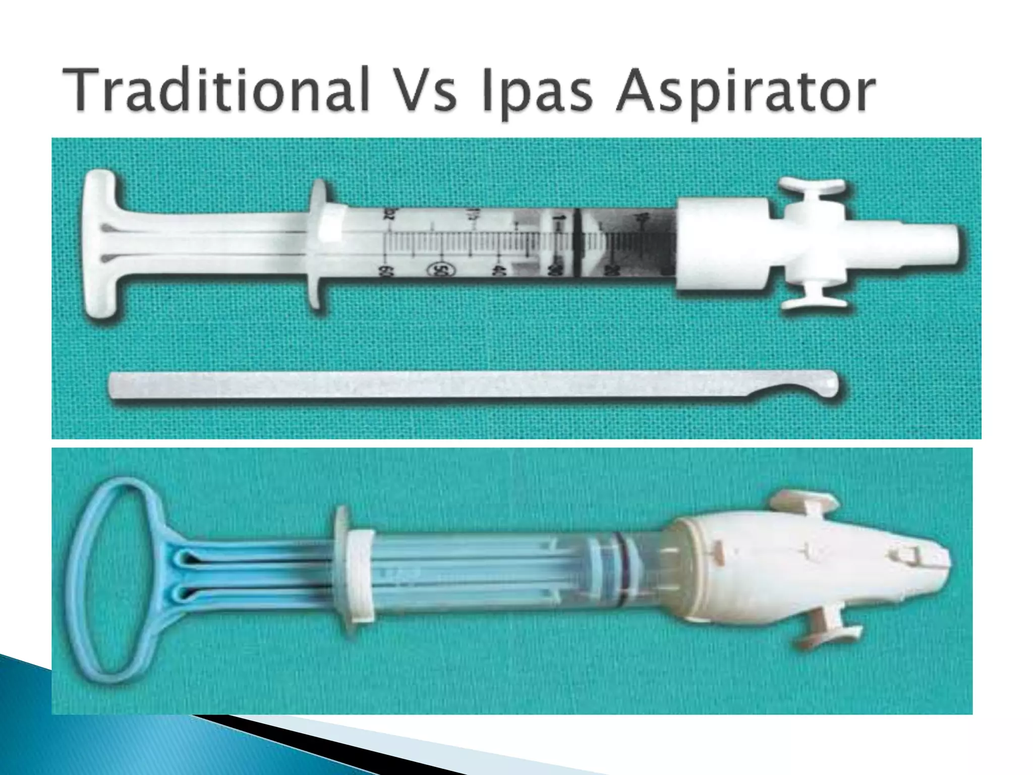 Manual vacuum aspiration | PPTX